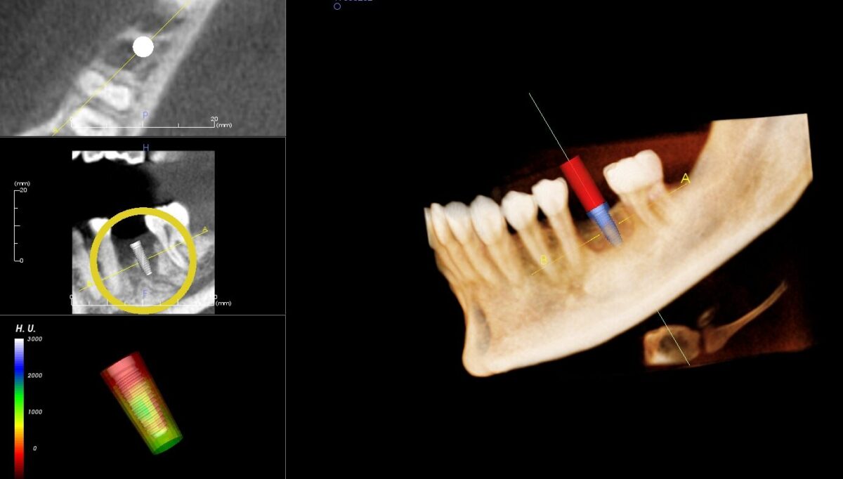 DEN 4 (CBCT) - Victorian Dental Imaging Group